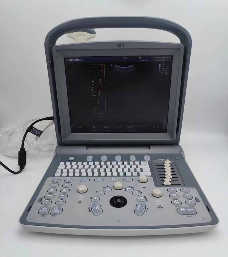 CHISON ECO 1 Portable Ultrasound Machine