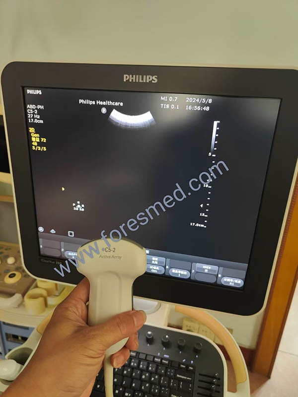PHILIPS ClearVue 350 Ultrasound Machine