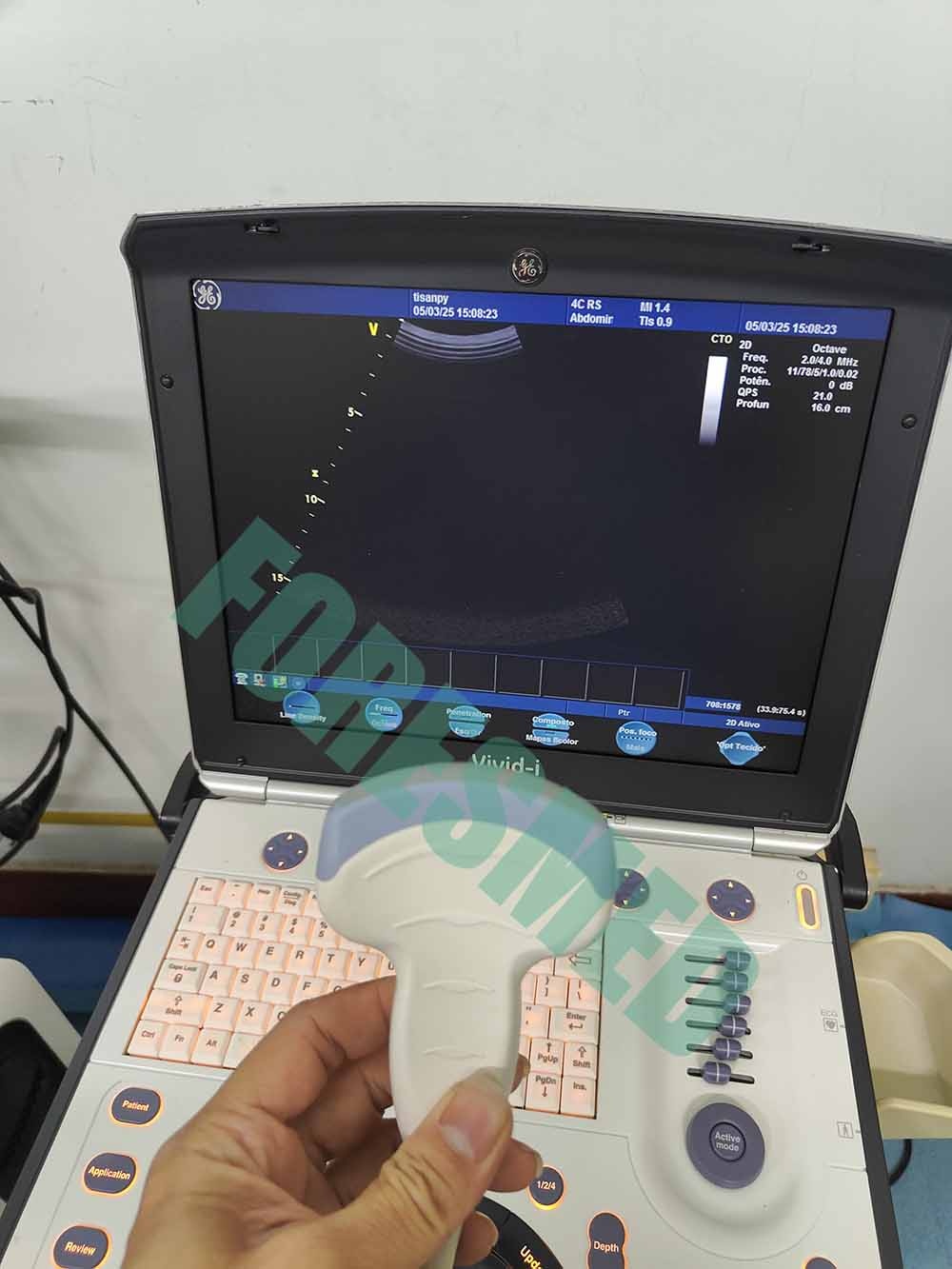 GE portable ultrasound system Vivid i